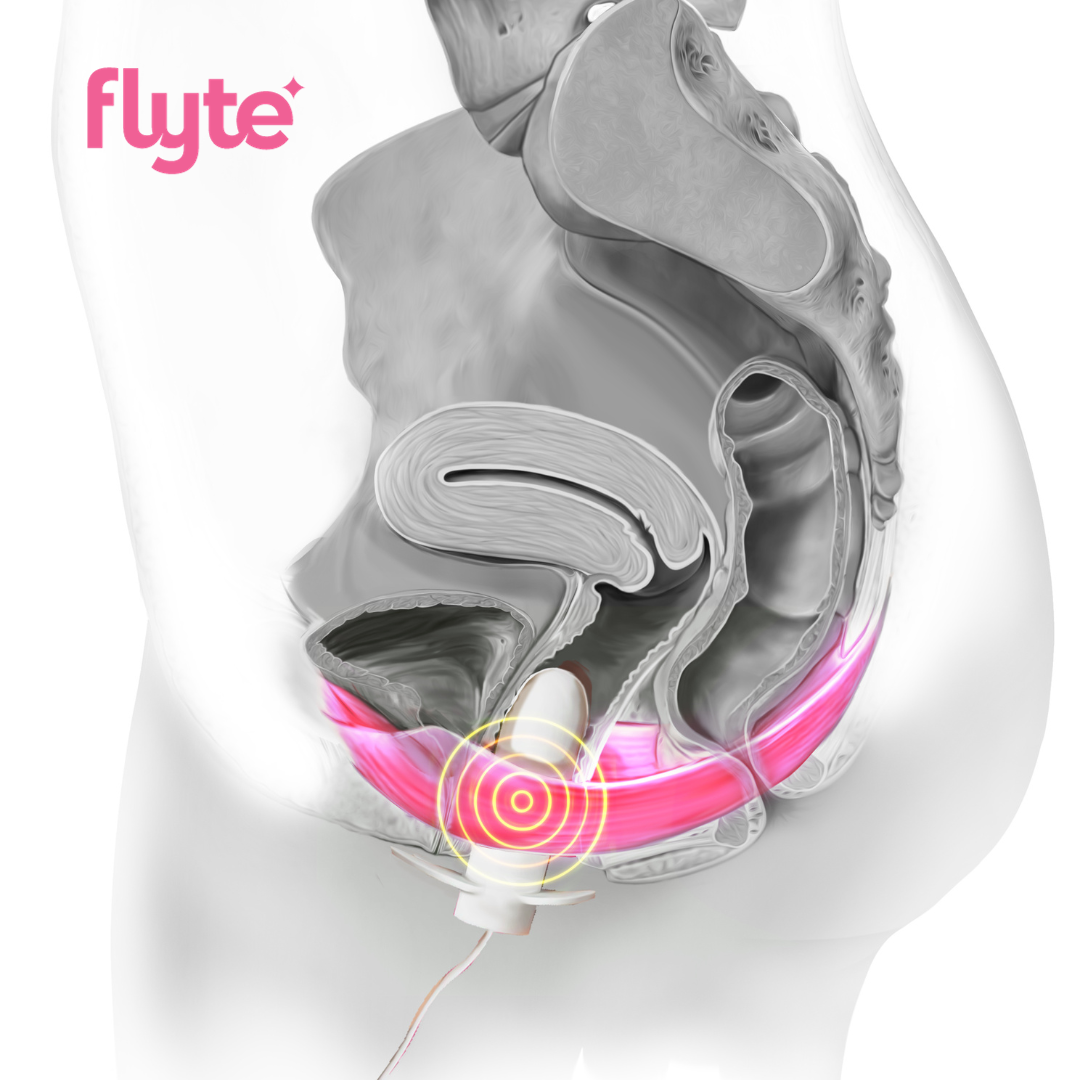 Flyte In-Home Pelvic Floor Therapy – Apria Home